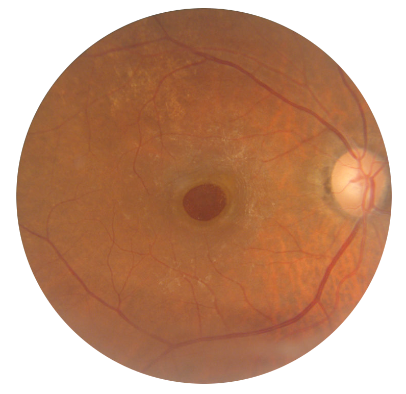 - All Vision Oftalmología y Óptica