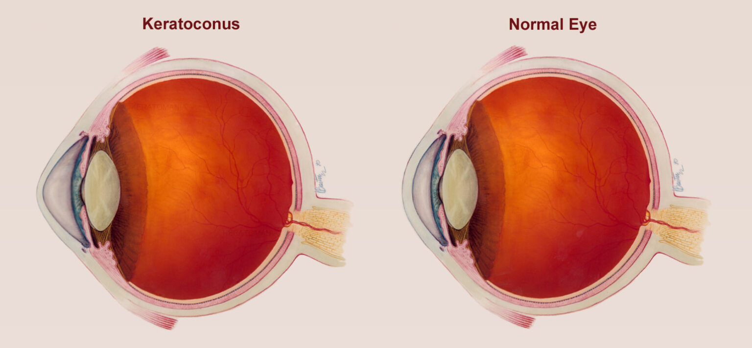 - All Vision Oftalmología y Óptica